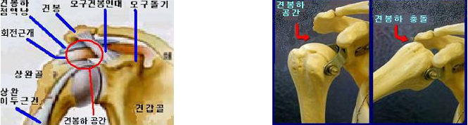충돌증후군 어깨통증의 비밀 오구돌기 제주 온기담은 한의원 교정클리닉 네이버 블로그